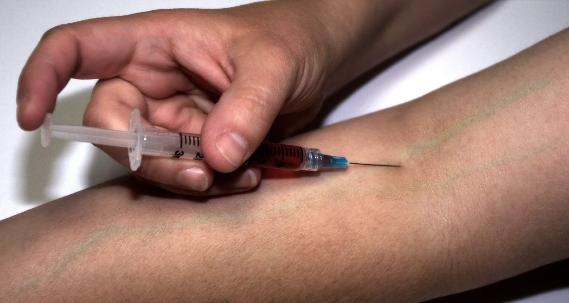 Platelet-Rich Plasma Injections as a Treatment Option for Chronic Pain
